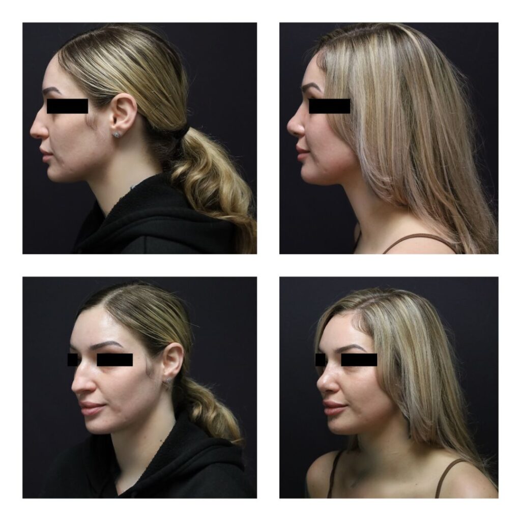 Jacobson Cosmetic Surgery - Lincoln NE Cosmetic Surgeon