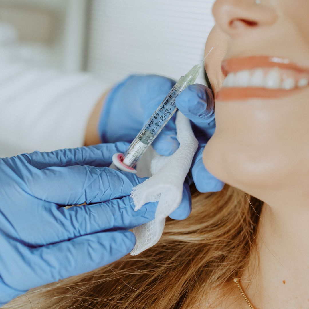 Lip Fillers - Jacobson Cosmetic Surgery